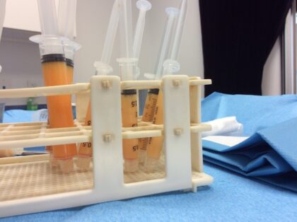 Fat Transfer to Hands Pittsburgh, PA | Beleza Plastic Surgery & Medical Spa